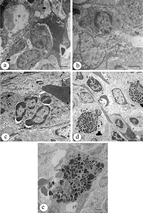 Electron Micrographs Of Rat Spleen From Fe Group Showing Asome