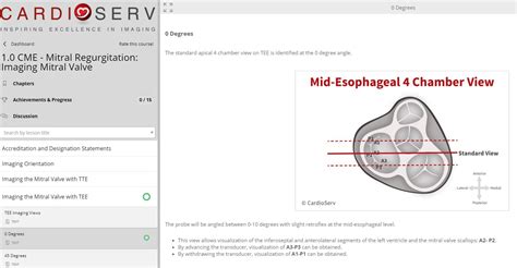 Online Echo Cmes Now Available Cardioserv