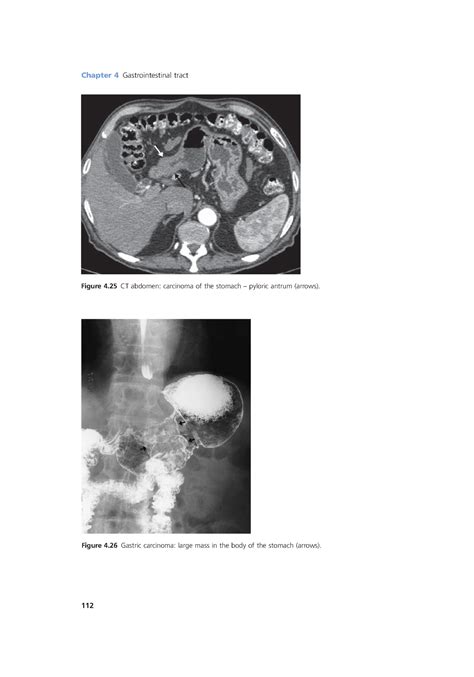 Radiology Lecture Notes Pdf 38 Chapter 4 Gastrointestinal Tract 112 Figure 4 Ct Abdomen
