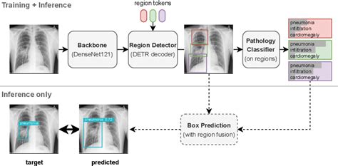 Figure 1 From Anatomy Driven Pathology Detection On Chest X Rays