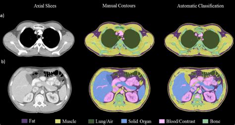 comparison of manual and automatic classification by classifier b and c
