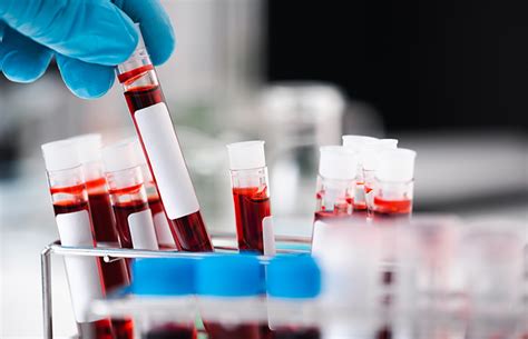 TruSight Oncology Portfolio