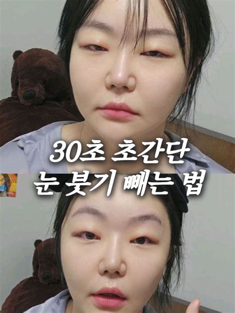 눈 붓기 빼는 초간단 마사지 방법 Tiktok