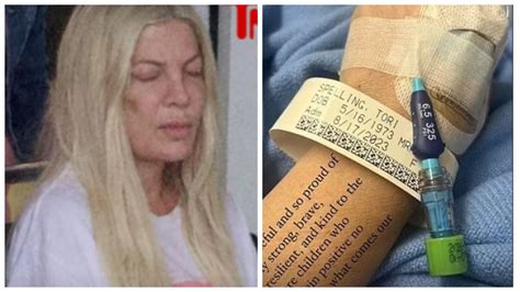 З синцями та в інвалідному візку що трапилося із зіркою Беверлі Хіллз