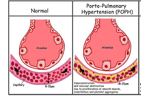 Rarediseasesinpediatricanesthesia