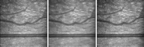 a original retinal image b log gabor denoising result c rényi