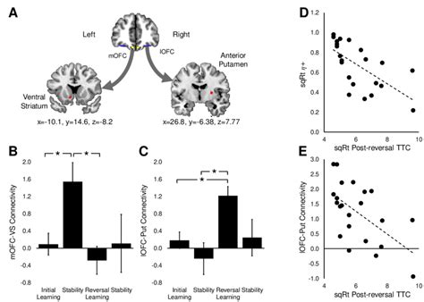Corticostriatal Connectivity And Its Relationship With Performance And Download Scientific