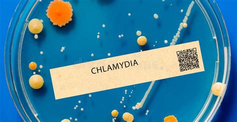 Chlamydia Sexually Transmitted Bacterial Infection That Can Cause
