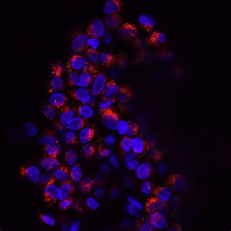 Workshop Spatial Multi Omics For Mapping Human Tissue Function Aging