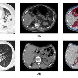 Regression Coefficients Unadjusted For Age And Sex Download Scientific Diagram