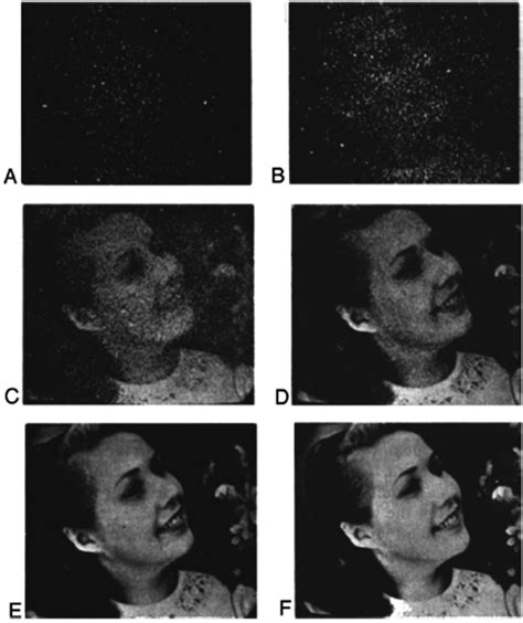 Signal Detection Theory A Brief History Radiology Key