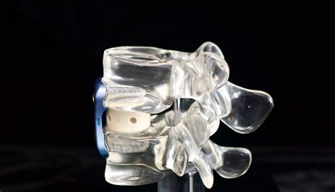 Neuro Spine Models And Surgical Procedures Melbourne