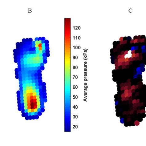 Nonparametric Pspm Paired T Test On Left Feet For Comparison Between Download Scientific