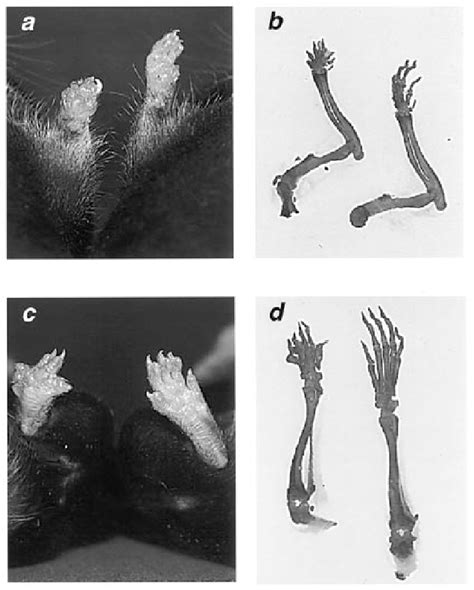 Metatarsal Bone Structure Semantic Scholar