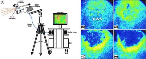 A Schematic Representation Of The Second Generation LSI Instrument Download Scientific