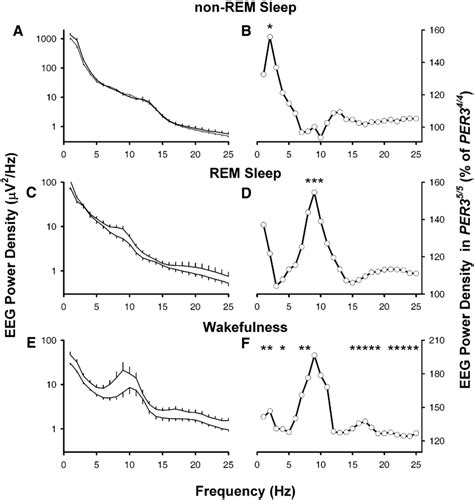 Eeg Power Spectra During Non Rem Sleep Rem Sleep And Wakefulness Download Scientific Diagram