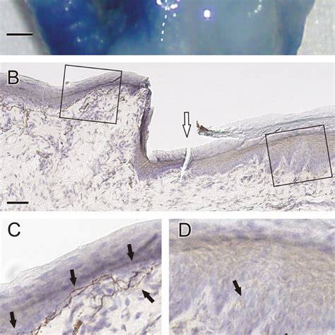 Cuff Stimulation Of Nerves The Stimulation Cuff Is Placed Over The Download Scientific Diagram