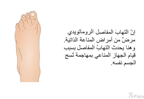 التهابُ المفاصل الناتج عن العدوى