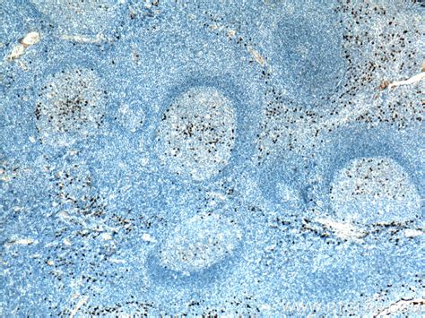 Human Igg Kappa Chain Antibody 67761 1 Pbs Proteintech
