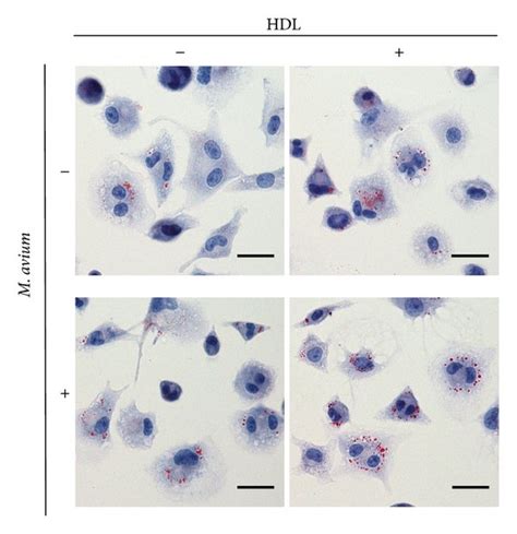 High Density Lipoprotein Hdl Promotes A Formation Of Thp 1