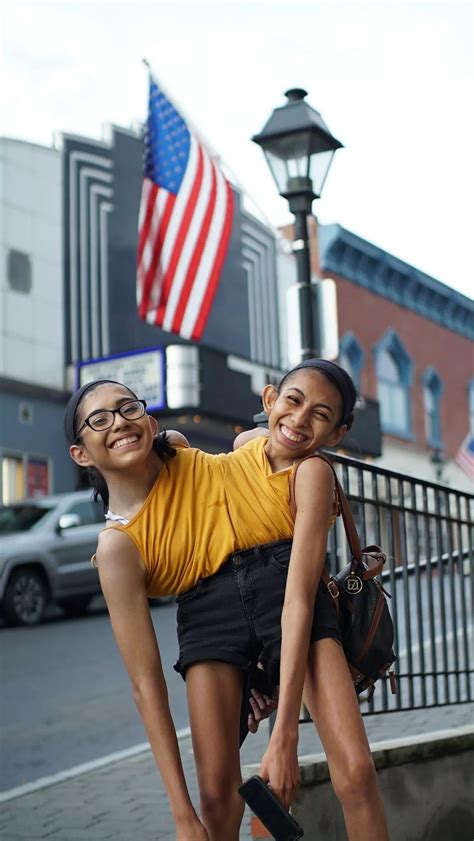 Extraordinary Life Of The Sisters Who Share One Body With One Leg Each