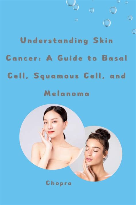 Understanding Skin Cancer A Guide To Basal Cell Squamous Cell And Melanoma Chopra Buch Jpc