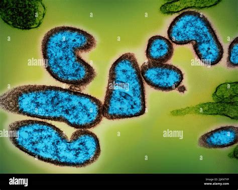 Nipah Virus Particles TEM Stock Photo Alamy