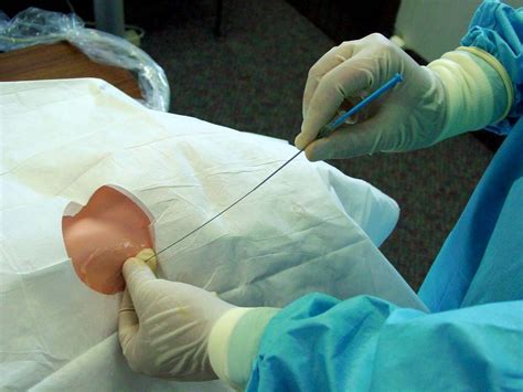 Clinical Notes Central Line Placement A Step By Step Procedure Guide With Photos