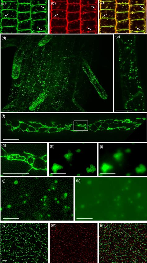 Figure 3 From Spatial Proteomics Of Vesicular Trafficking Coupling