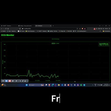 Girish Ingale On Linkedin ️ Remote Ecg Monitoring System ️ 🌟 Overview