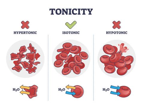60 Hypotonic Stock Illustrations Royalty Free Vector Graphics And Clip