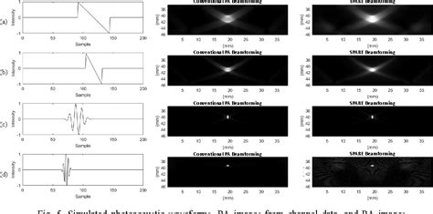 Figure 2 From Synthetic Aperture Based Photoacoustic Re Beamforming Spare Approach Using