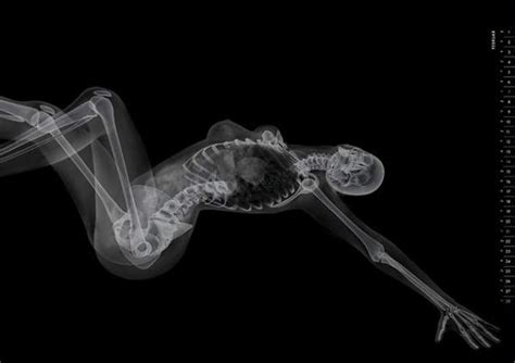 X Ray Pin Up Calendar Photos