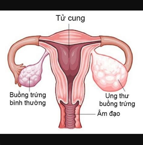 Top B Nh Ung Th Th Ng G P Ph N V C Ch Ph Ng Tr Nh Toplist Vn