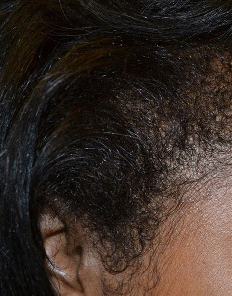 Batana Natural Hair Growth Oil Azure