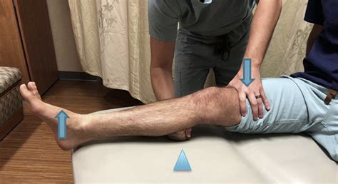 Lever Sign A Better Acl Exam Technique — Journalfeed