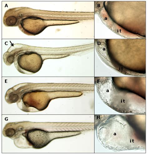 Microinjection Of Zebrafish Embryos To Analyze Gene Function