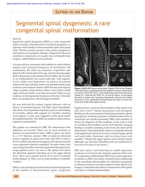 Pdf Segmental Spinal Dysgenesis A Rare Congenital Spinal Malformation