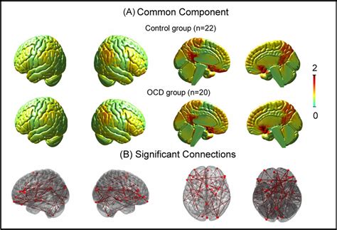 Represents The Features And Advantage Of Individual Fmri Space With A Download Scientific