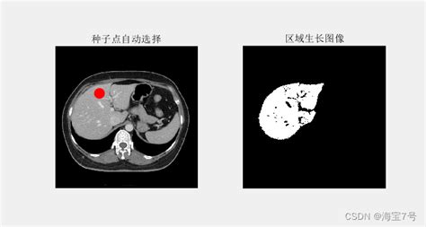 【第 26 章 基于最小误差法和区域生长的医学影响分割系统 matlab深度学习实战gui项目】 基于matlab gui的医用系统开发 csdn博客