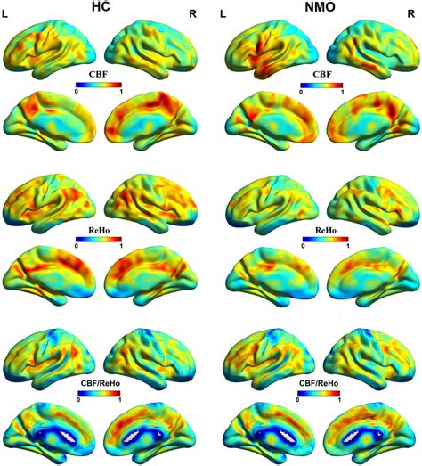 Spatial Distribution Maps Of Cbf Reho And Cbf Reho Ratio In Healthy