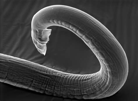 Roundworm Protein Is Promising New Epilepsy Treatment Epilepsy In English