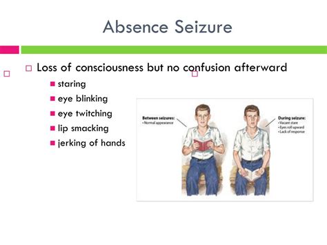 Ppt Seizure Protocol Powerpoint Presentation Free Download Id 4950598