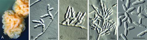 Tricellula Aurantiaca Cpc 36629 A Colony On Sna B D Conidiogenous Download Scientific