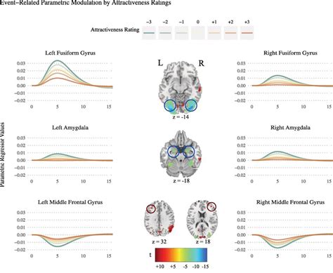 Brain Activations Pattern For The Parametric Modulation By Perceived Download Scientific