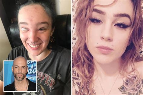 Graphic Pics Of Hannah Daughtry Reveal How Chris Daughtrys Stepdaughter Was Shot In Eye Before