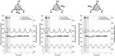 Innovative Intravalvular Impedance Sensing Applied To Biological Heart Valve Prostheses Design