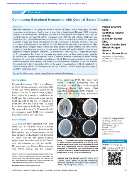 Pdf Contrecoup Extradural Hematoma With Coronal Suture Diastasis