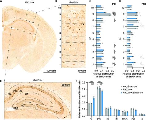 Neuronal Migration Defects In The Cortex And Hippocampus Of R402h