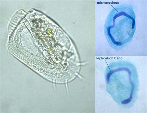 Protist Images Euplotes Eurystomus